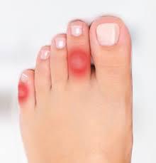 Quand venir consulter ? :: Centres de Podologie Lausanne - Vevey - Yverdon